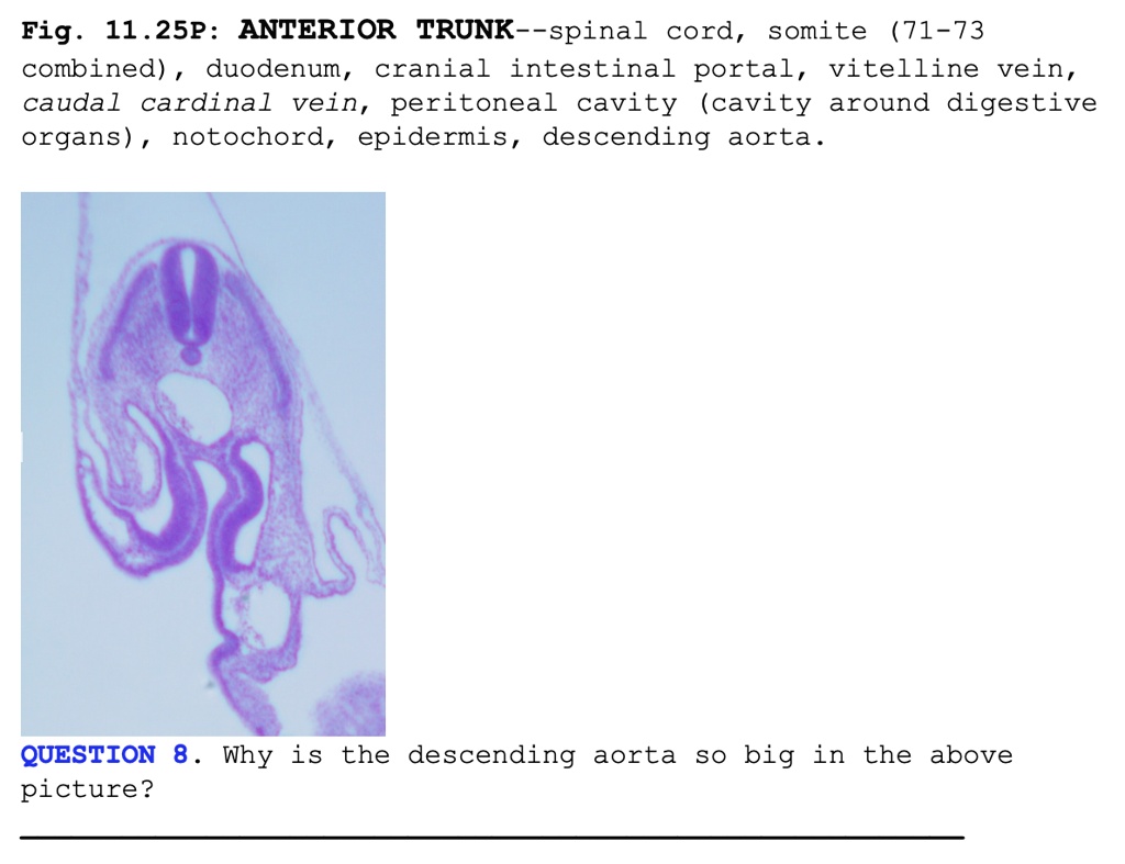 SOLVED: Fig. 11.25P: ANTERIOR TRUNK–spinal cord, somite (71-73 combined ...