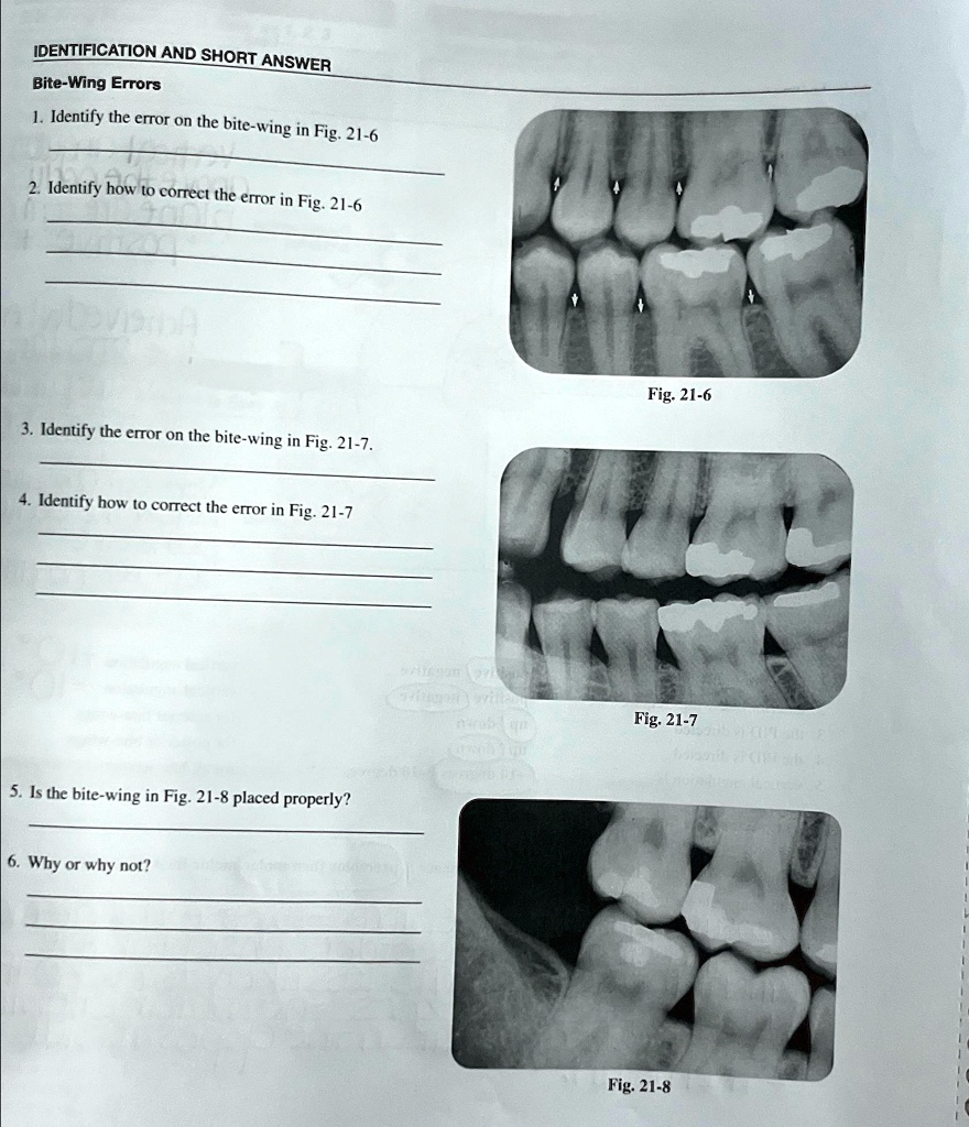 IDENTIFICATION AND SHORT ANSWER Bite-Wing Errors 1. Identify the error ...