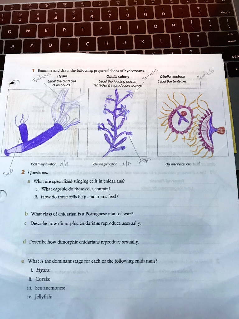 geletd tenun en examine and draw the following prcpared slides of ...