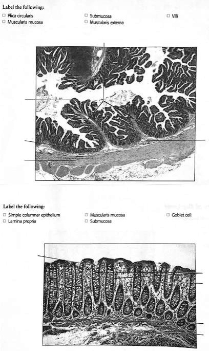 SOLVED: Label the following: Plicae circulares Muscularis mucosae ...
