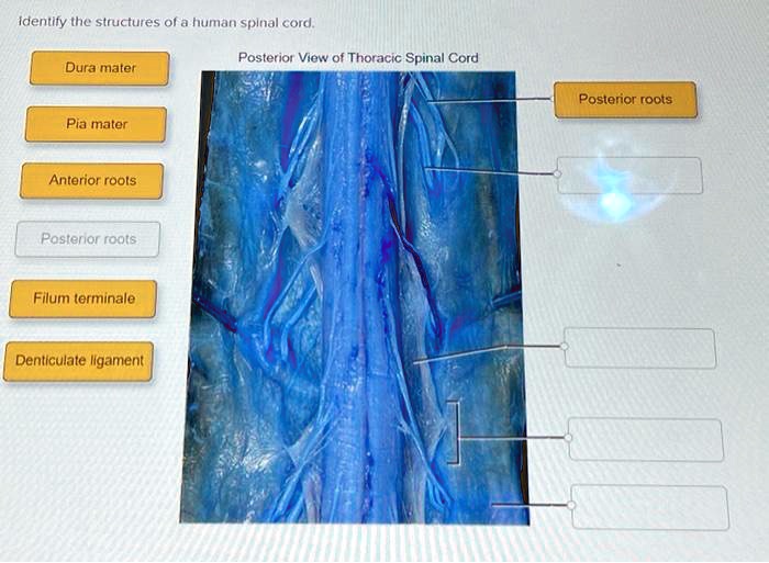SOLVED: Text: Identify the structures of a human spinal cord Dura mater ...