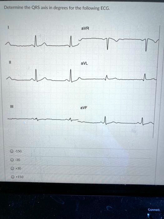 SOLVED: Determine the QRS axis in degrees for the following ECG aVR aVL ...