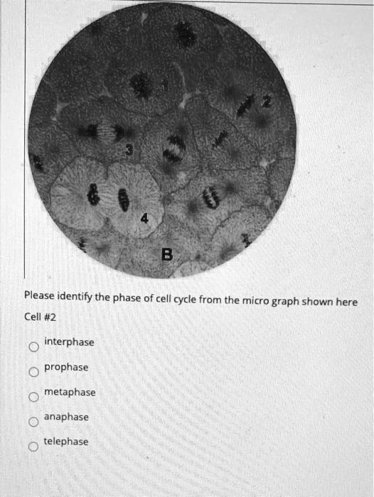 SOLVED: Please identify the phase of cell cycle from the micro graph ...
