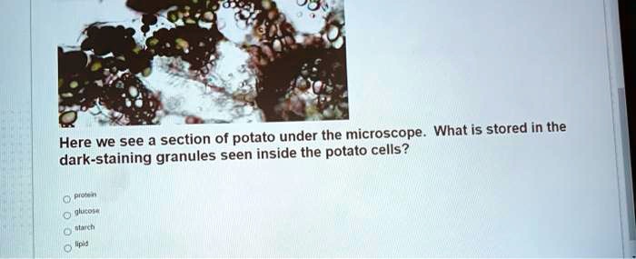 SOLVED: under the microscope What is stored in the Here we see a ...
