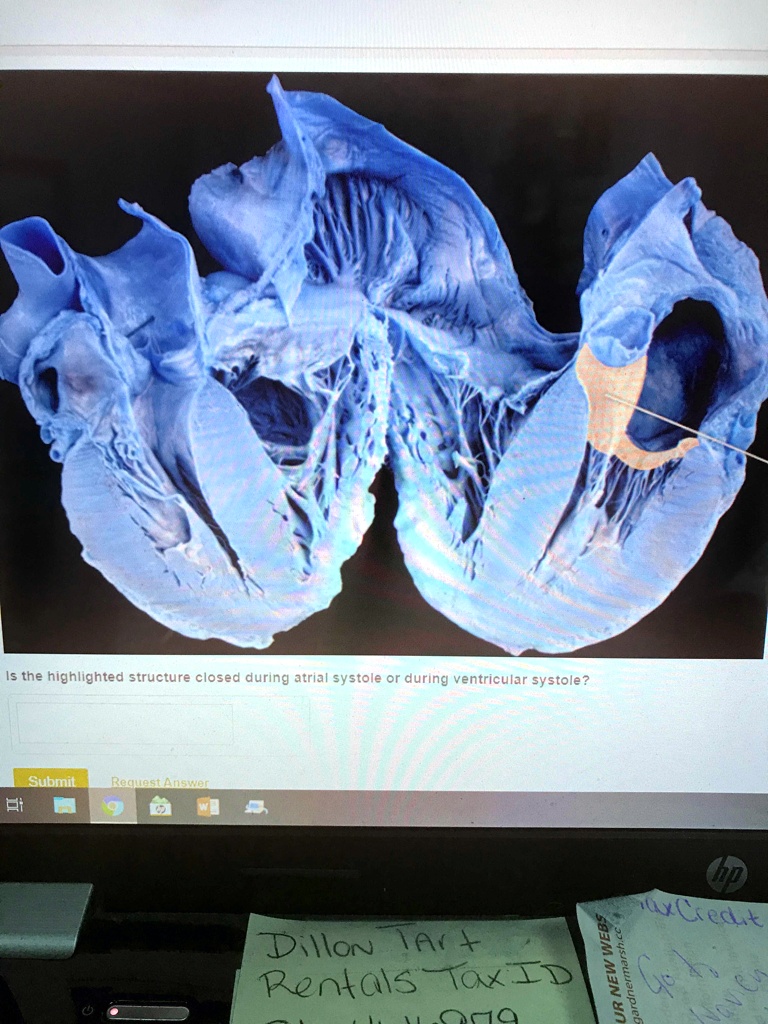 SOLVED: Is the highlighted structure closed during atrial systole or during ventricular systole ...