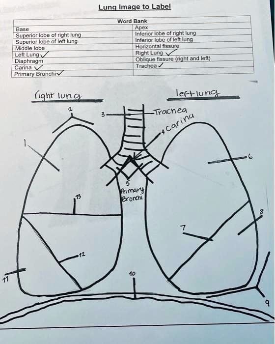 Lung Image to Label Word Bank: Apex, Inferior lobe of right lung ...