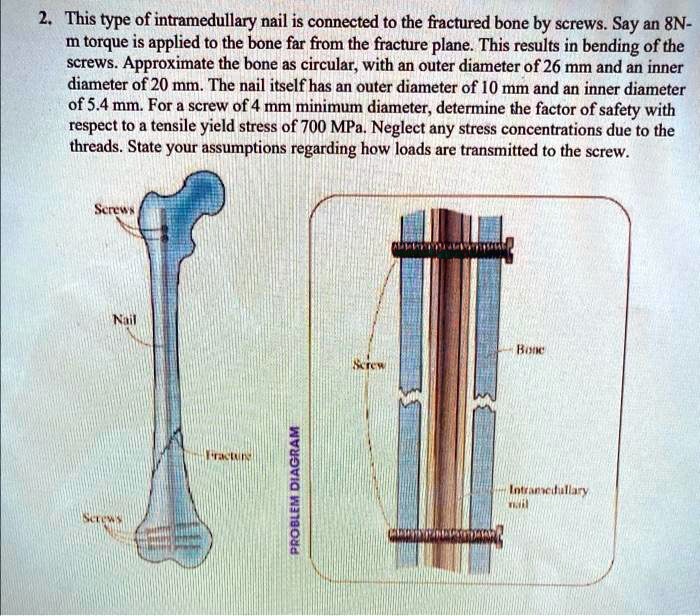 2. This type of intramedullary nail is connected to the...