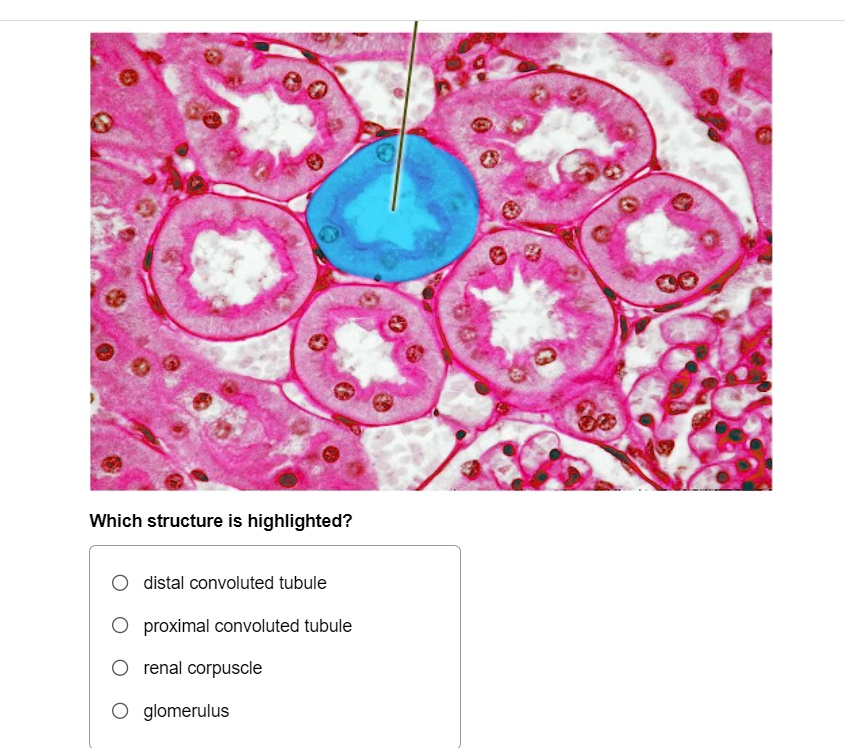 Which structure is highlighted? distal convoluted tubule proximal convoluted tubule renal ...