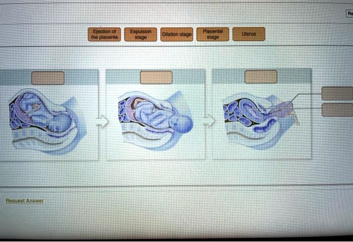 SOLVED: Ejection of the placenta Stage Dilation stage Stage Uterus