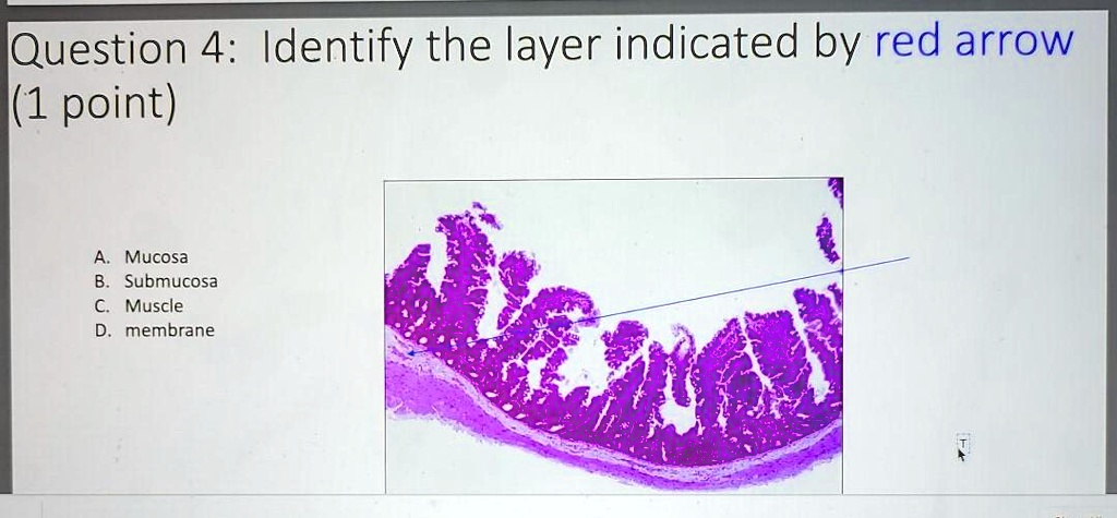 SOLVED: Question 4: Identify the layer indicated by red arrow (1 point) Mucosa Submucosa Muscle ...