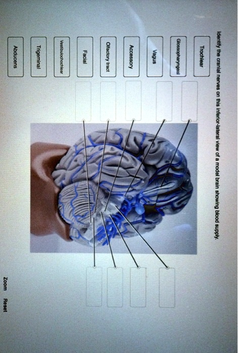 Identify the cranial nerves on this inferior-lateral view of...