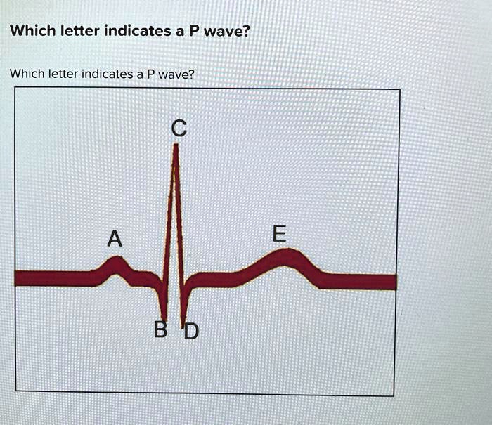 SOLVED: Which letter indicates a P wave? Which letter indicates a P ...