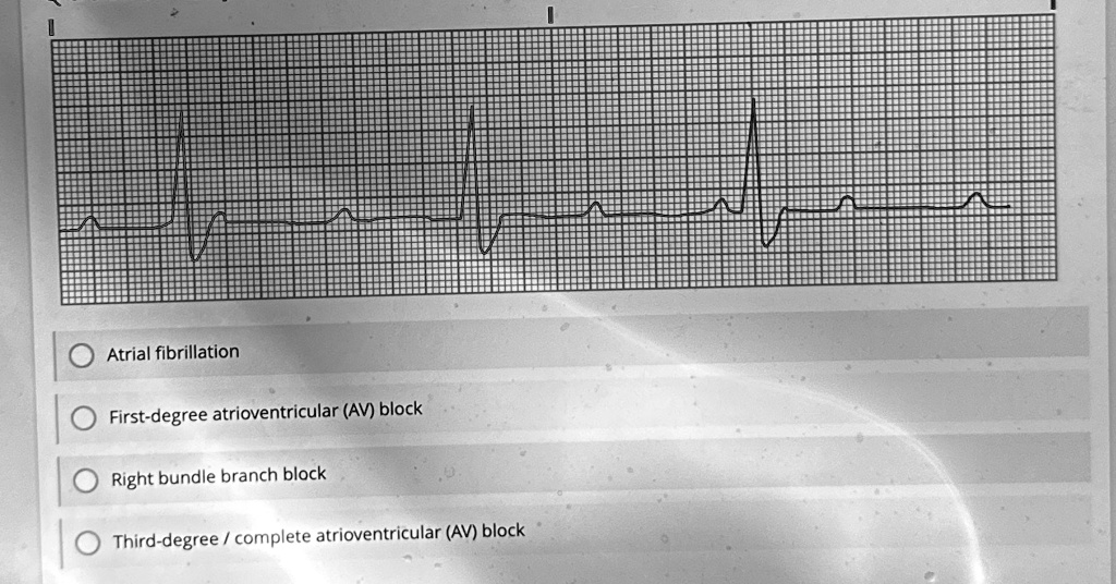 SOLVED: Atrial fibrillation First-degree atrioventricular (AV) block ...