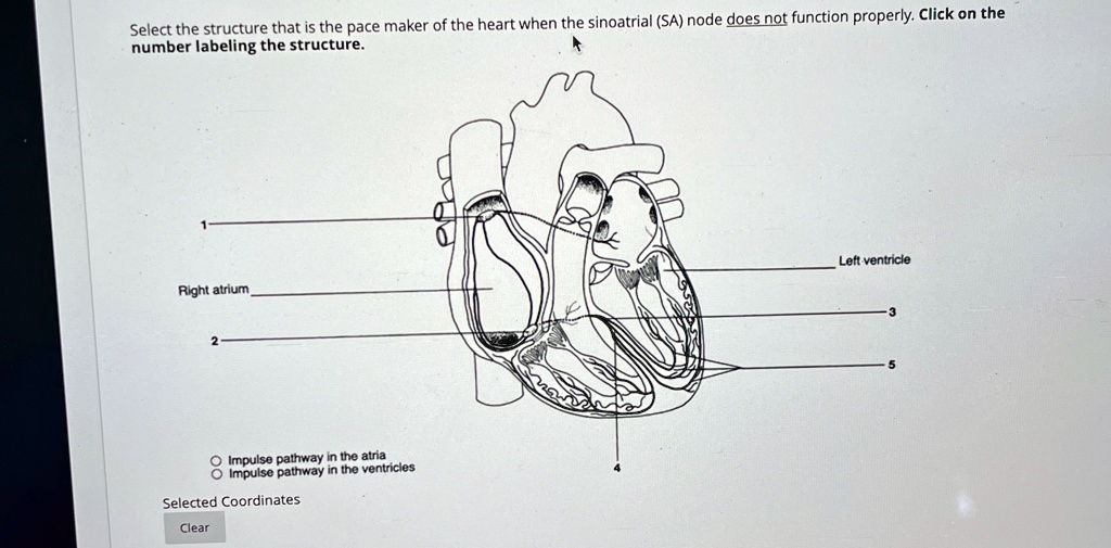 Select the structure that is the pace maker of the heart when the ...