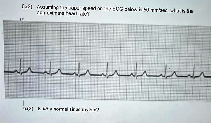 5.2 Assuming the paper speed on the ECG below is 50 mm/sec, what is the ...