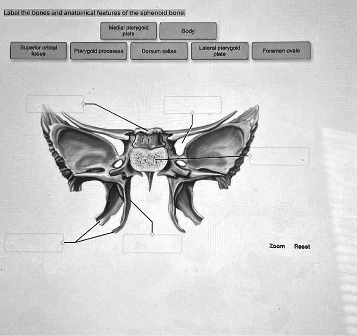 texts label the bones and anatomical features of the sphenoid bone ...