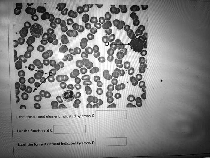 SOLVED:Label the formed element indicated by arrow â‚¬ List the ...