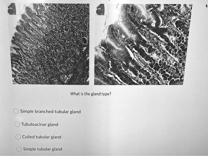 What is the gland type? Simple branched tubular gland Tubuloacinar ...