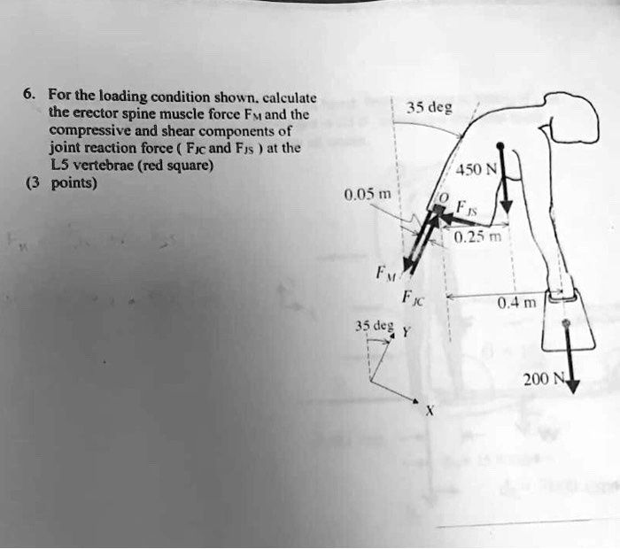 SOLVED: For the loading condition shown, calculate the erector spine ...