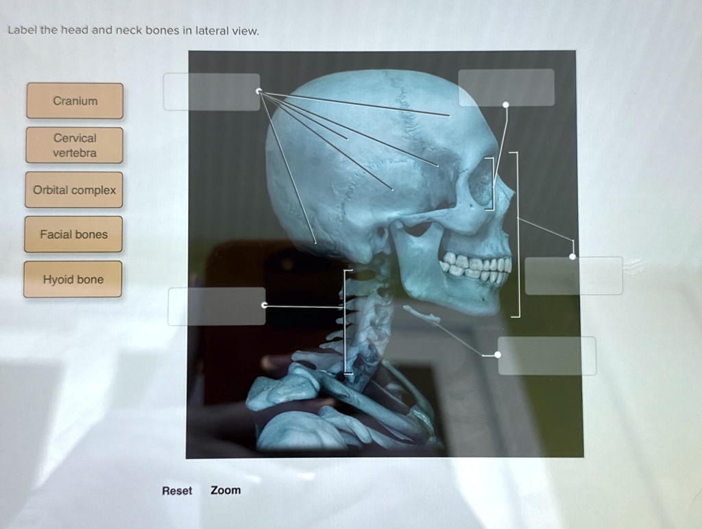 Label the head and neck bones in lateral view. Cranium Cervical ...