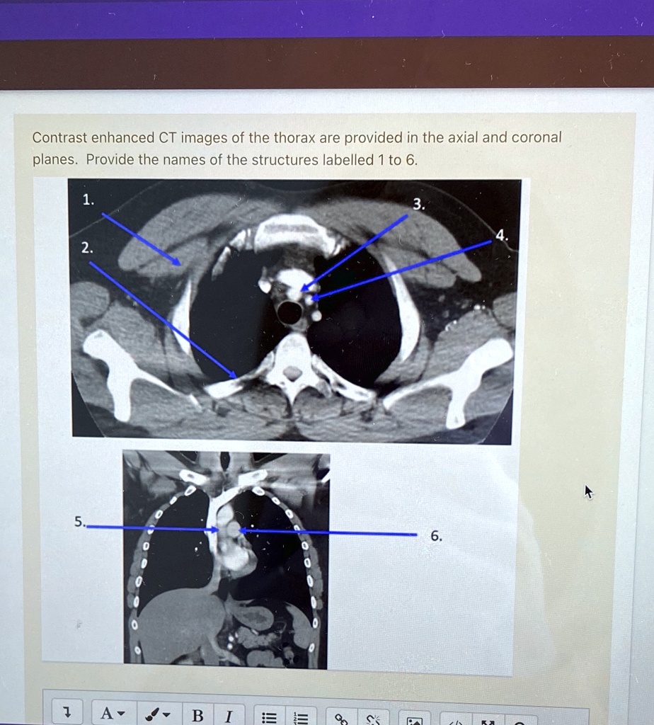 SOLVED: 'Can you please answer my question Contrast enhanced CT images ...