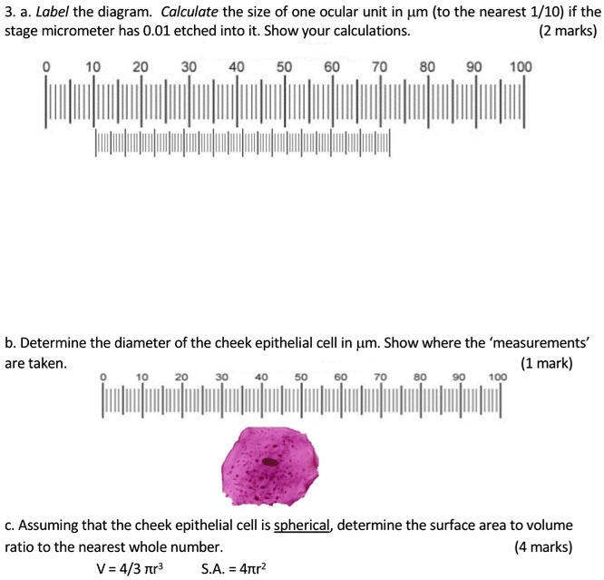 SOLVED: Label The Diagram: Calculate The Size Of One Ocular Unit In Um ... SOLVED: Label The Diagram: Calculate The Size Of One Ocular Unit In Um ...
