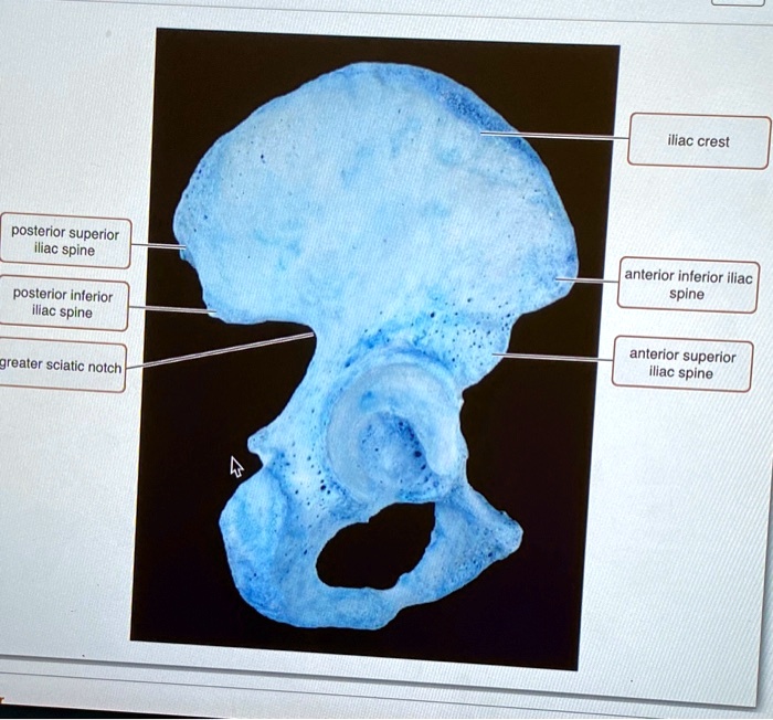 SOLVED: iliac crest posterior superior iliac spine anterior inferior iliac spine posterior ...
