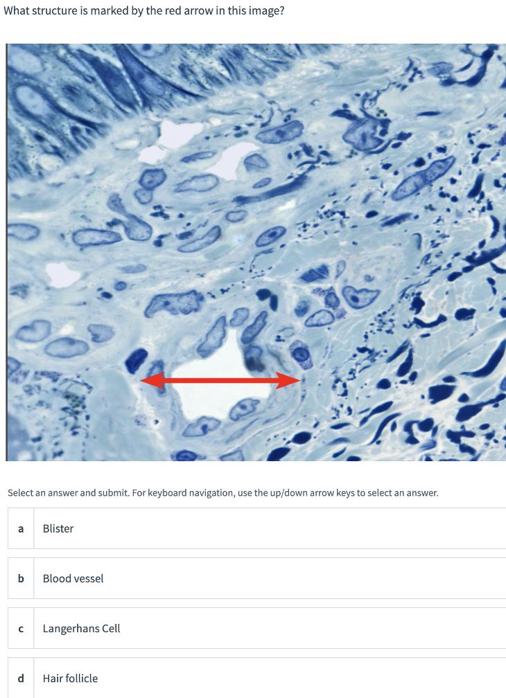 what structure is marked by the red arrow in this image select an answer and submit for keyboard ...