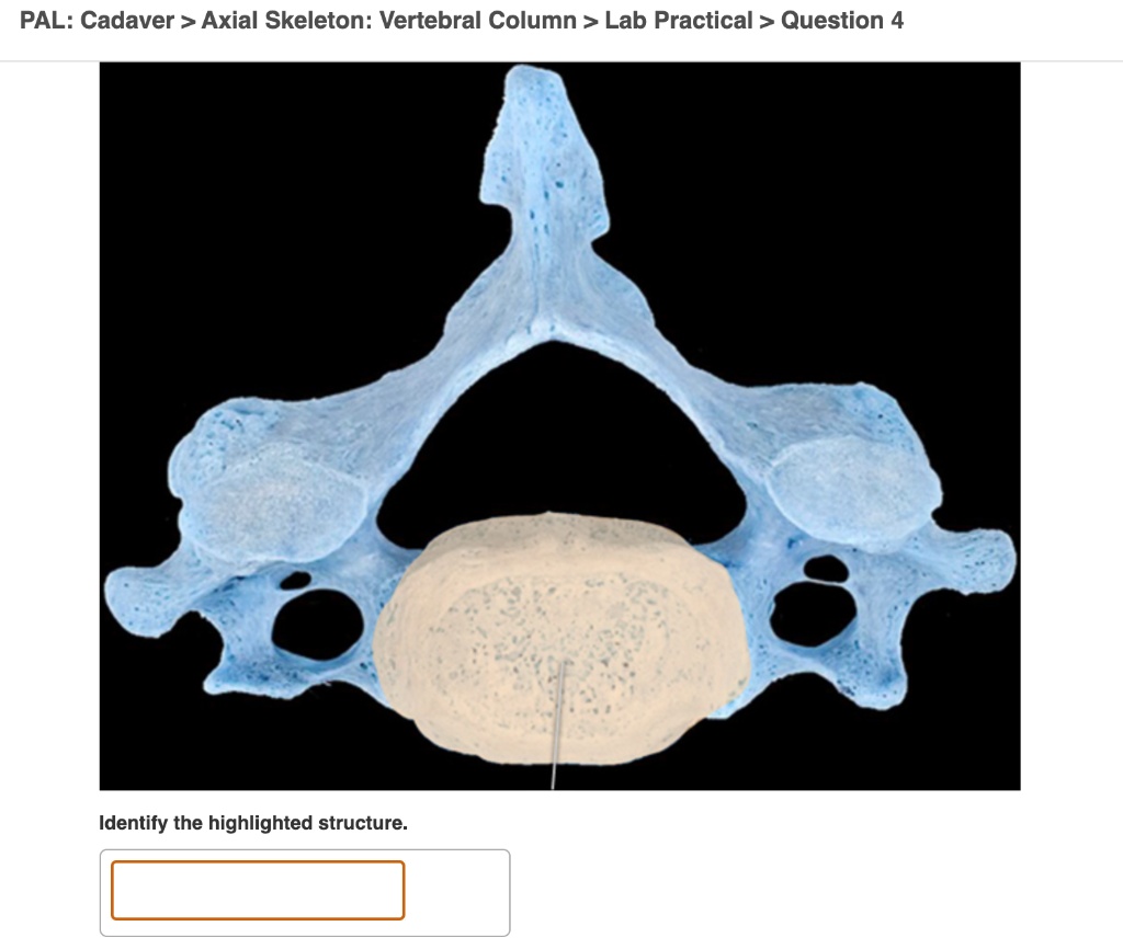 SOLVED: PAL: Cadaver > Axial Skeleton: Vertebral Column > Lab Practical > Question 4 Identify ...
