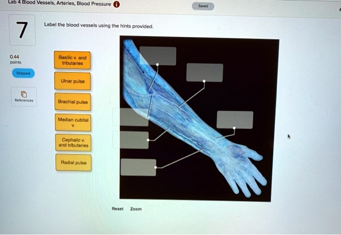 SOLVED: Blood Vessels, Arteries, Blood Pressure Label the blood vessels ...