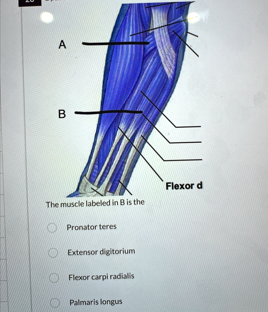 A B The muscle labeled in B is the Pronator teres Extensor digitorium ...