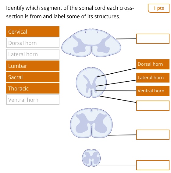 SOLVED: Identify which segment of the spinal cord each cross-section is ...