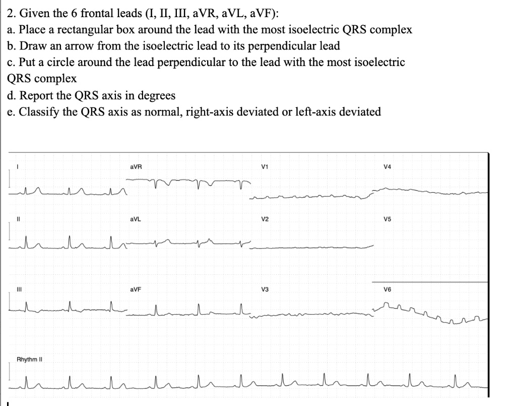 2. Given the 6 frontal leads (I, II, III, aVR, aVL, aVF): a. Place a ...