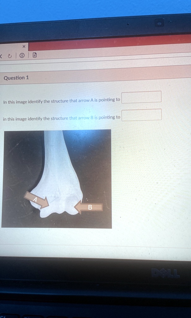 question 1 in this image identify the structure that arrow a is pointing to in this image ...