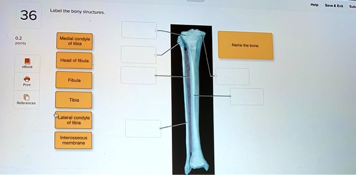 SOLVED: Label the bony structures. Help Save Exit Sut 36 0.2 points ...