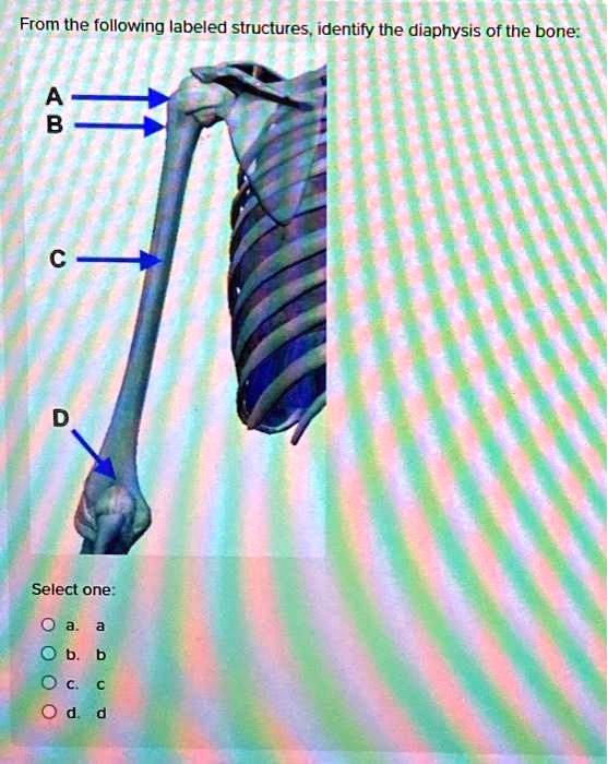 SOLVED: Texts: From the following labeled structures, identify the diaphysis of the bone: A B C ...