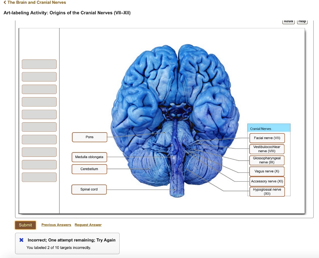 Which 2 did I get wrong? The Brain and Cranial Nerves Art-labeling ...