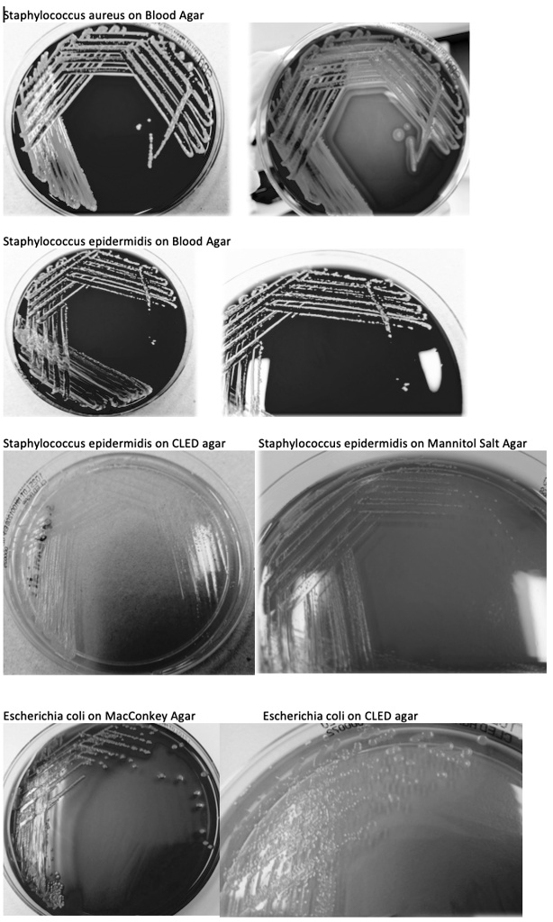 Staphylococcus aureus on Blood Agar Staphylococcus epidermidis on Blood ...
