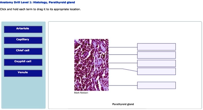 SOLVED: Anatomy Drill Level 1: Histology, Parathyroid Gland Arteriole ...