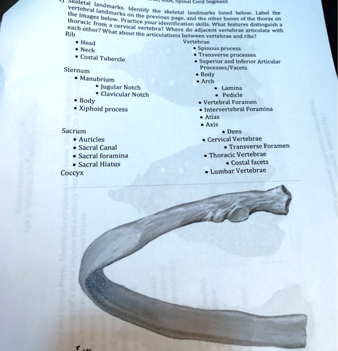 SOLVED: Iarcordsement Rib, Head, Neck, Costal Tubercle, Sternum ...