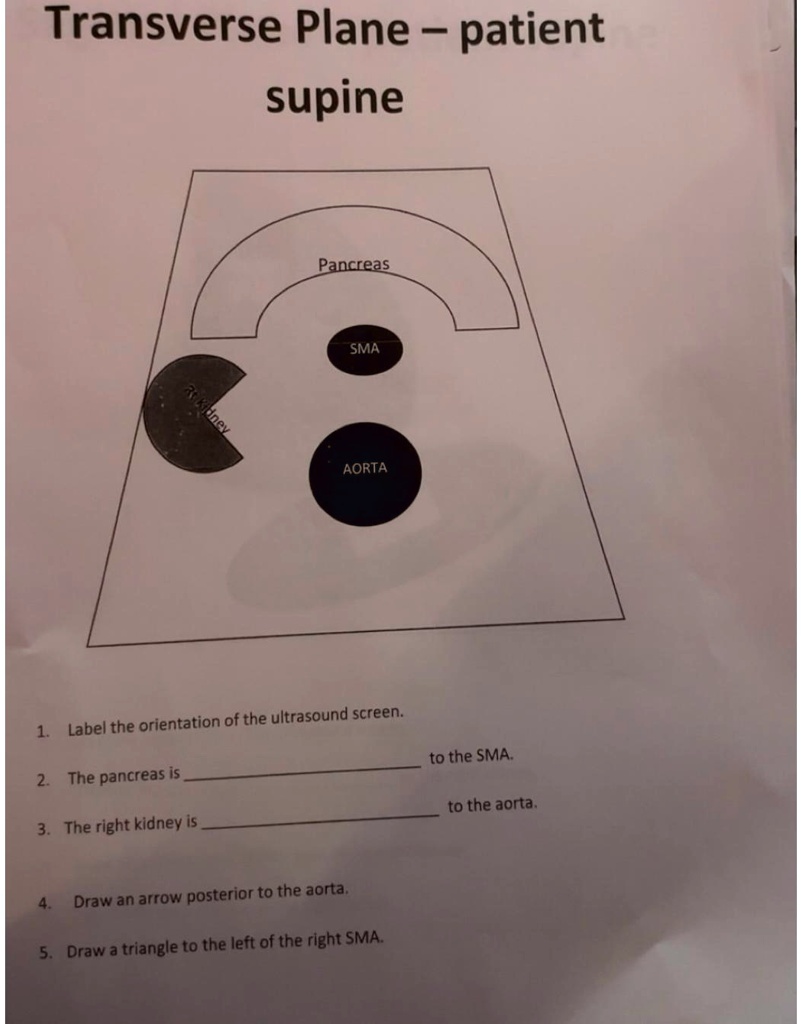 SOLVED: Transverse Plane - patient supine Label the orientation of the ...