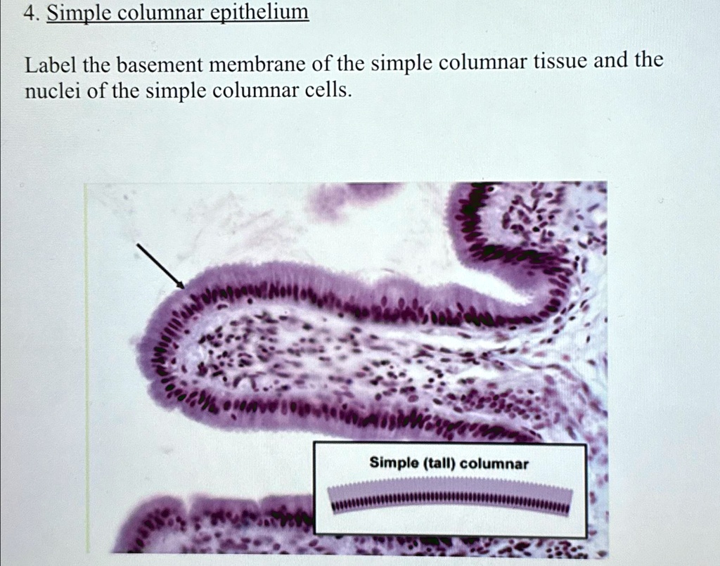 4. Simple columnar epithelium Label the basement membrane of the simple ...