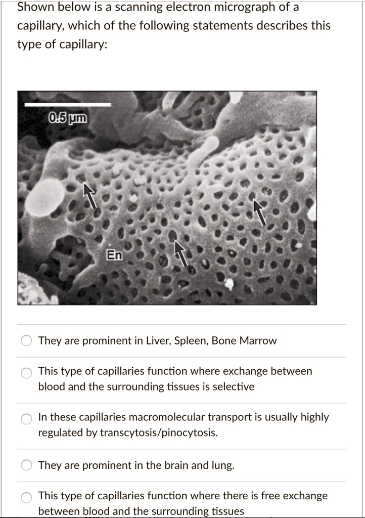 Shown below is a scanning electron micrograph of a capillary, which of ...