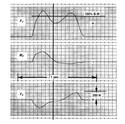 100% B.W 9 Fy Mz 7 1 sec. Fx 200 N 8