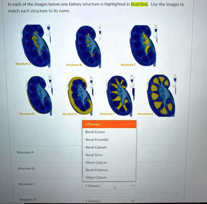 SOLVED: In each of the images below, one kidney structure is ... SOLVED: In each of the images below, one kidney structure is ...