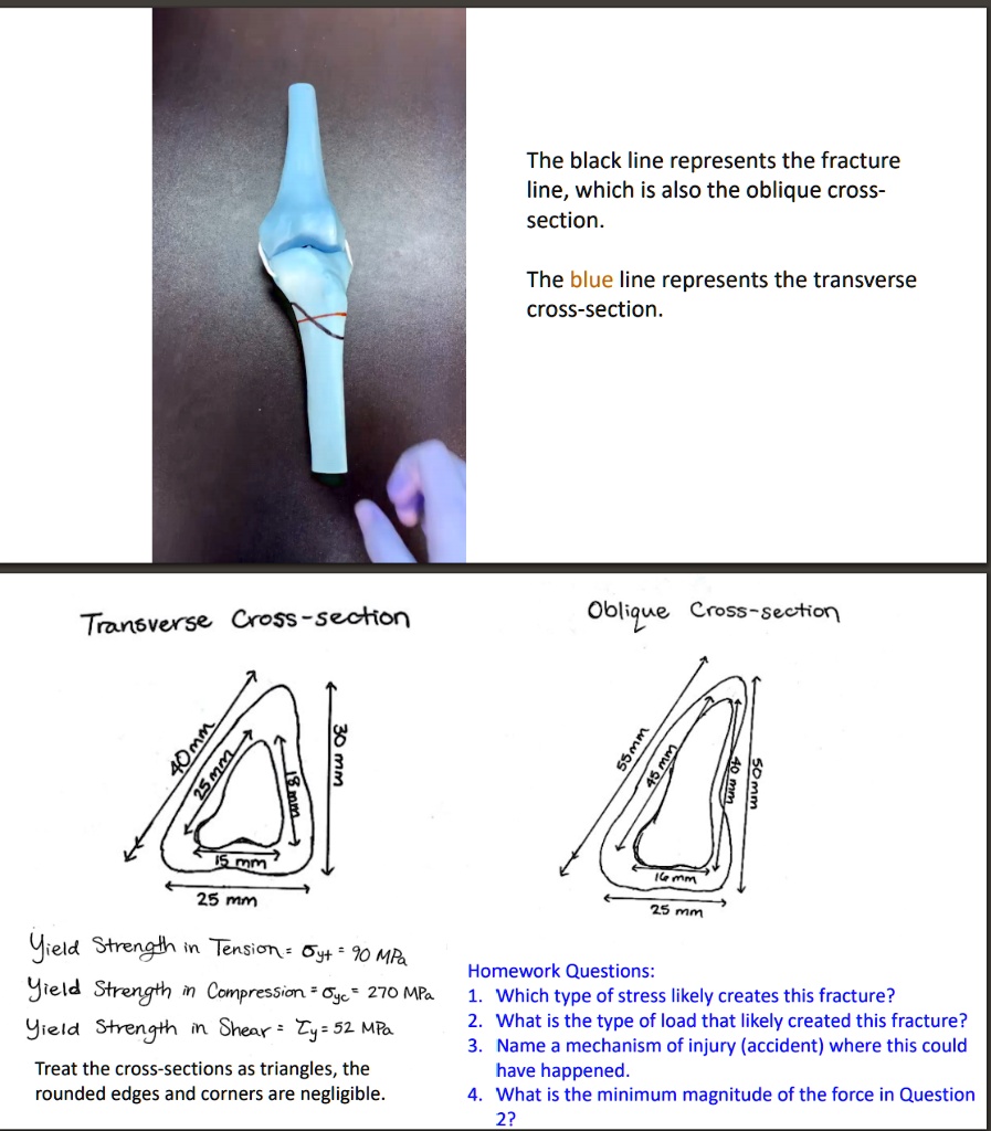 SOLVED: The black line represents the fracture line, which is also the ...