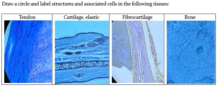 Draw a circle and label structures and associated cells in the following tissues: Tendon ...