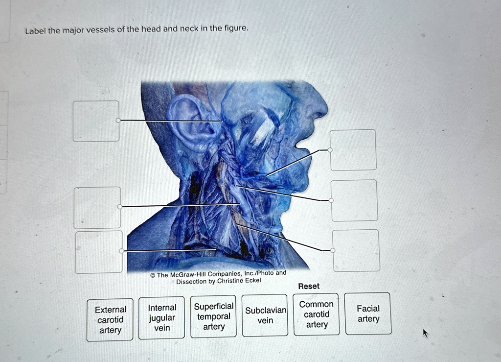label the major vessels of the head and neck in the figure the mcgraw ...