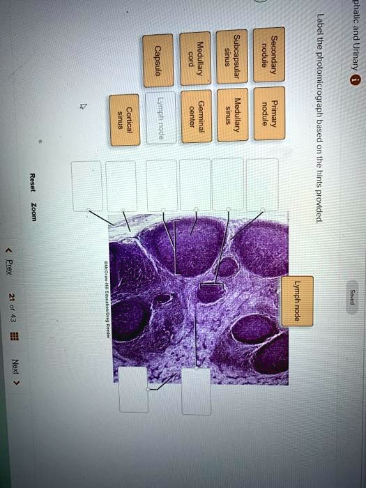 SOLVED: Capsule cord Medullary sinus Subcapsular nodule Secondary ...