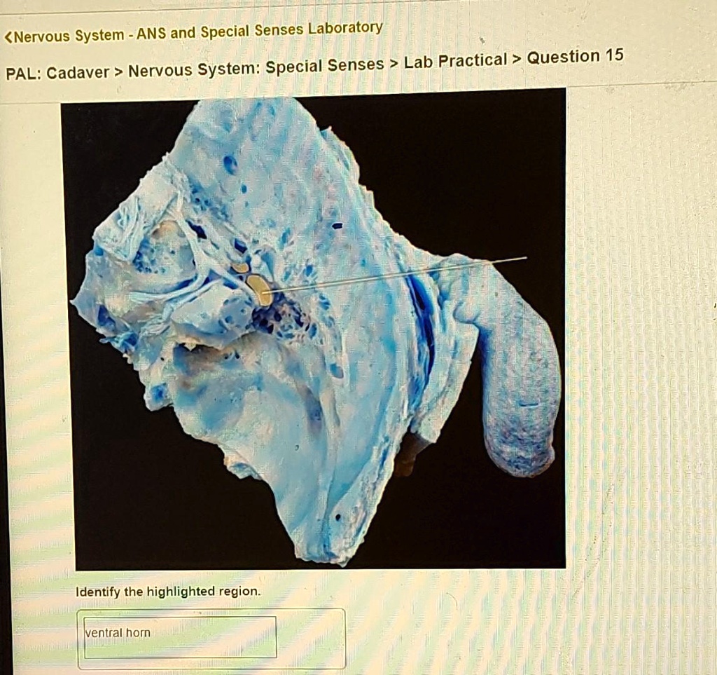 SOLVED: Nervous System - ANS and Special Senses Laboratory PAL: Cadaver ... SOLVED: Nervous System - ANS and Special Senses Laboratory PAL: Cadaver ...